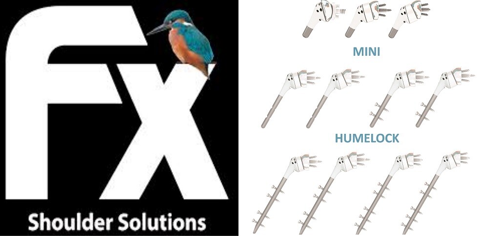 FX Solution - a look back to the American Adventure