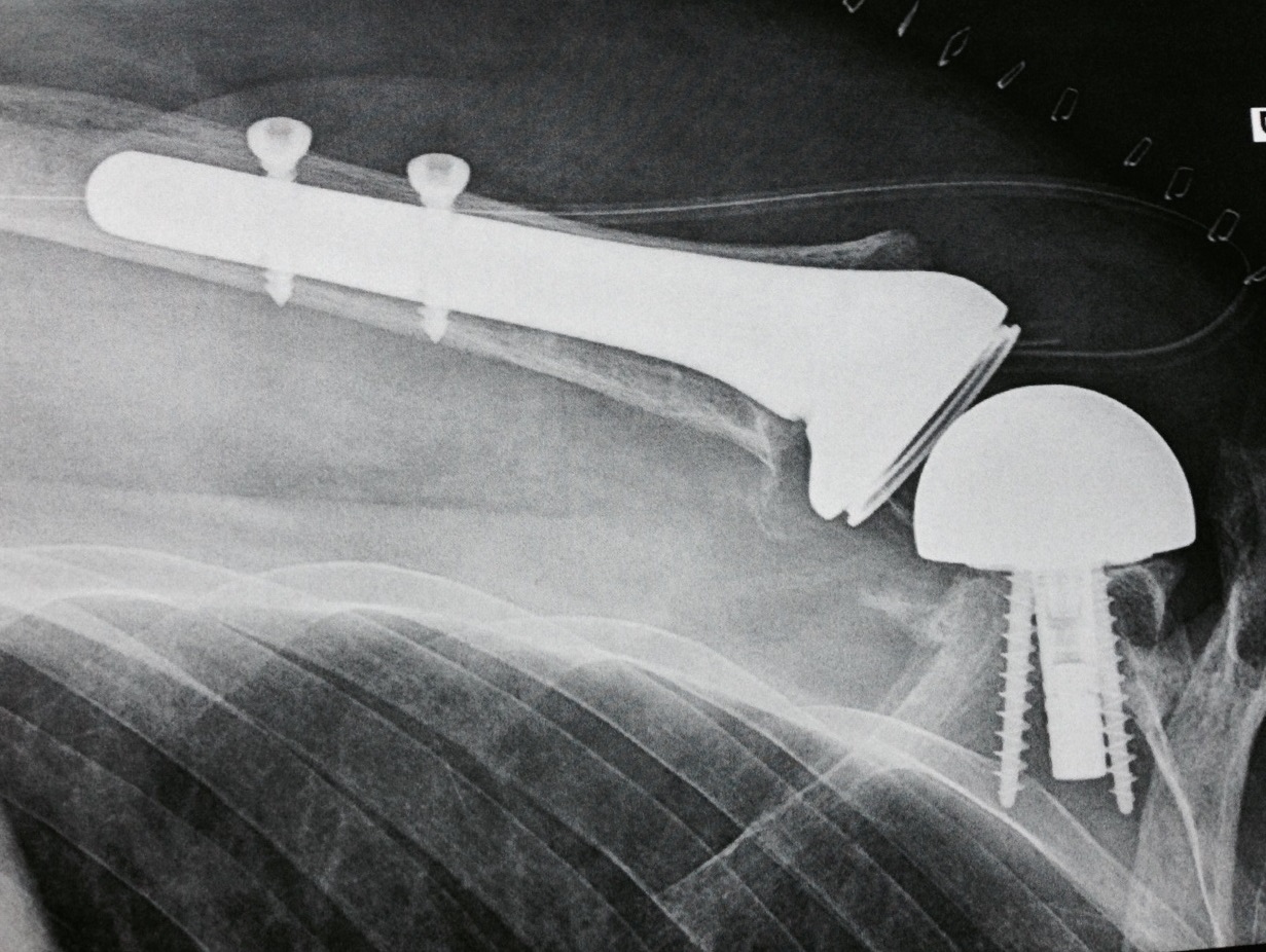 Retour sur l’aventure américaine de FX Solutions